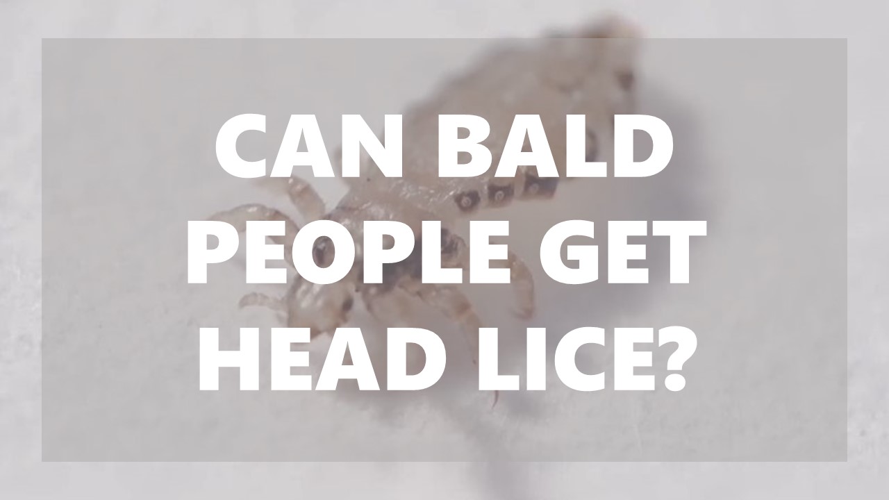 BaldAndHappy.com | For Happier Hairless Heads