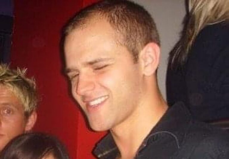 Norwood 2 Example Hairlines and Advice | BaldAndHappy.com