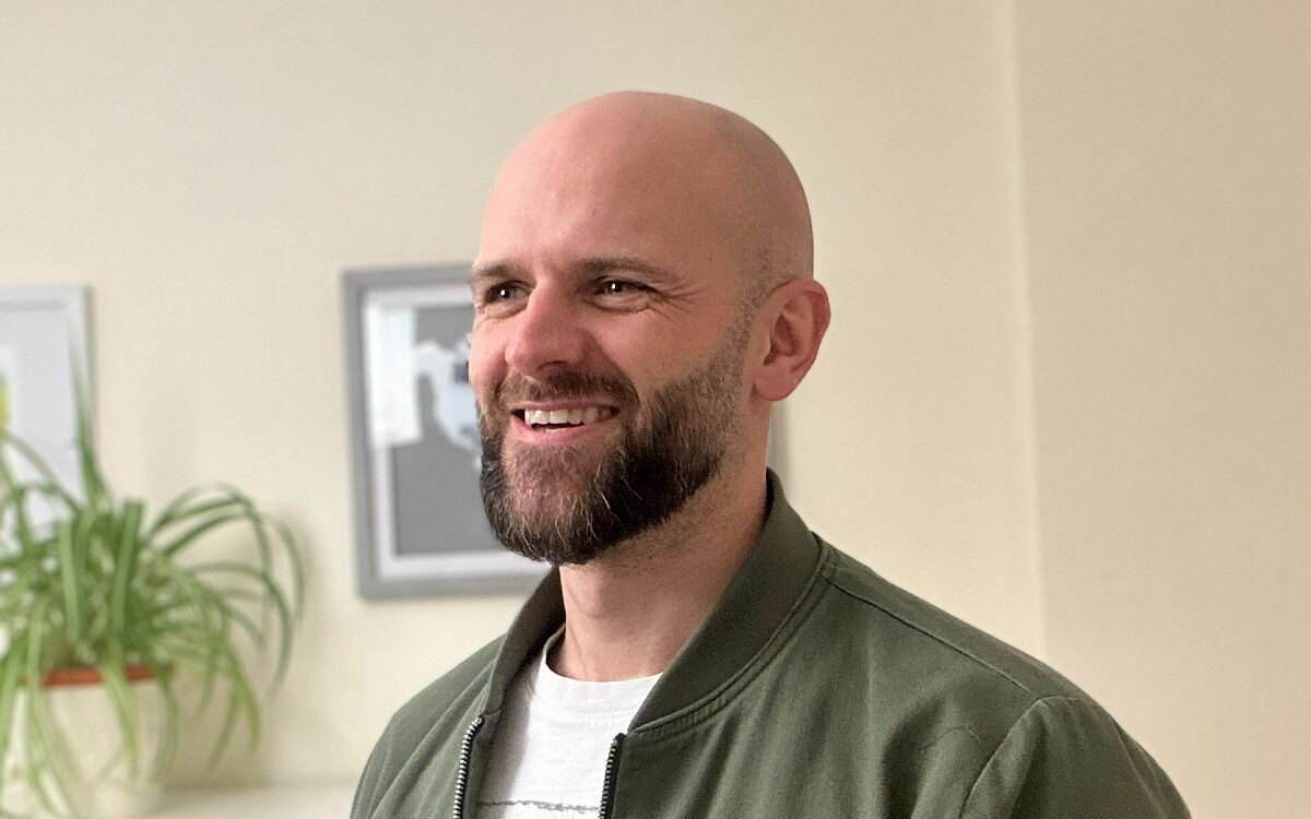 Bald On Top, Hair On Sides: Style Options for 2024